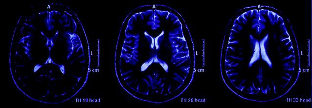 CEREBRUM - Ulule