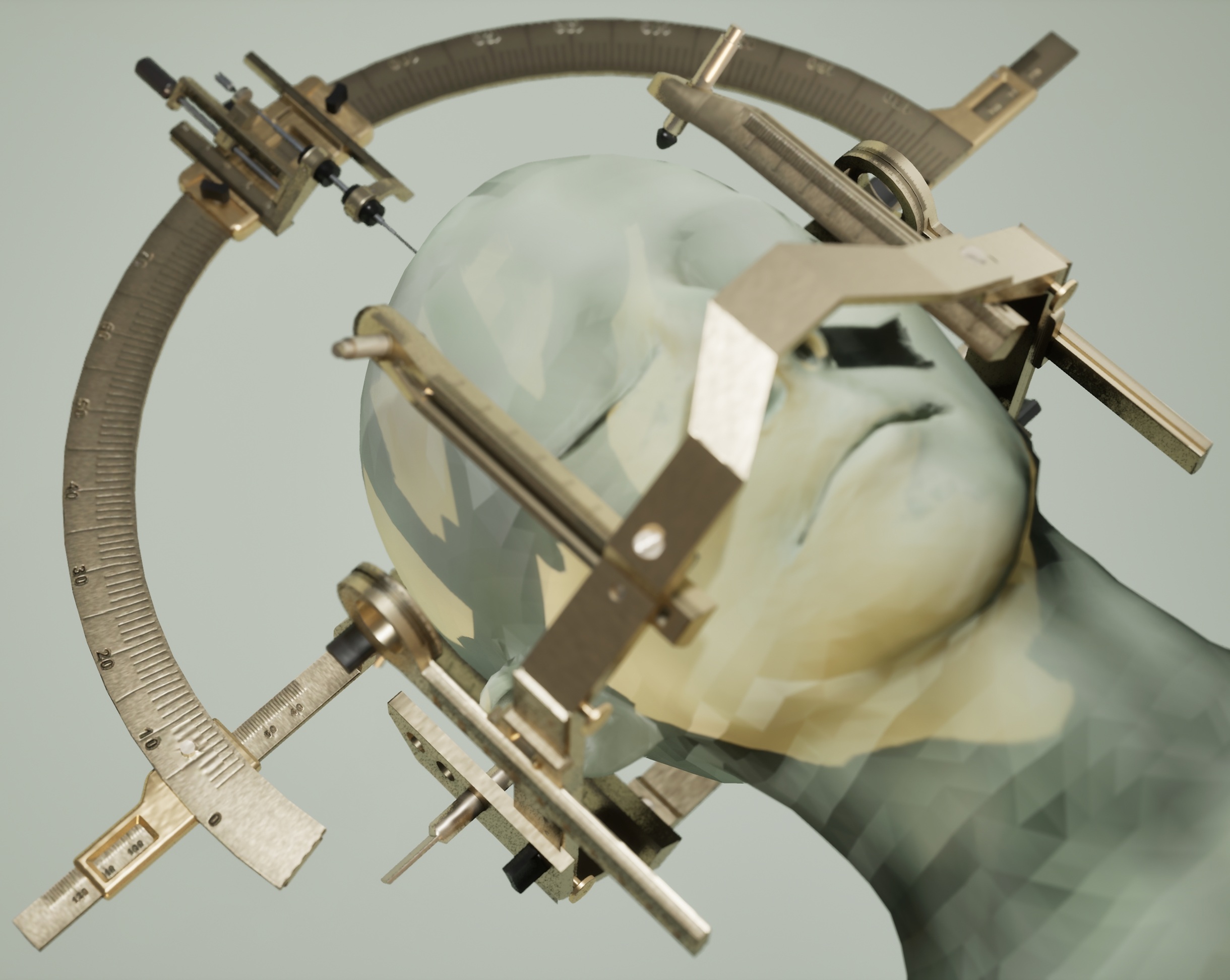 Vr-Surgery-Training - Ulule